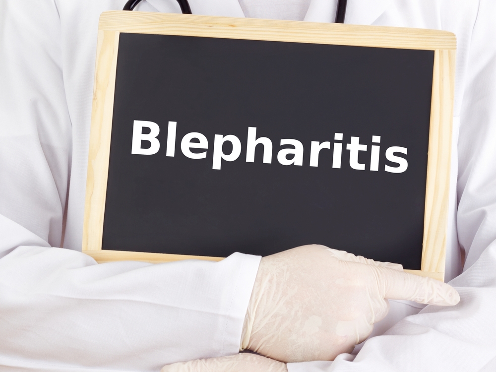 Causes and Symptoms of Blepharitis - Facty Health
