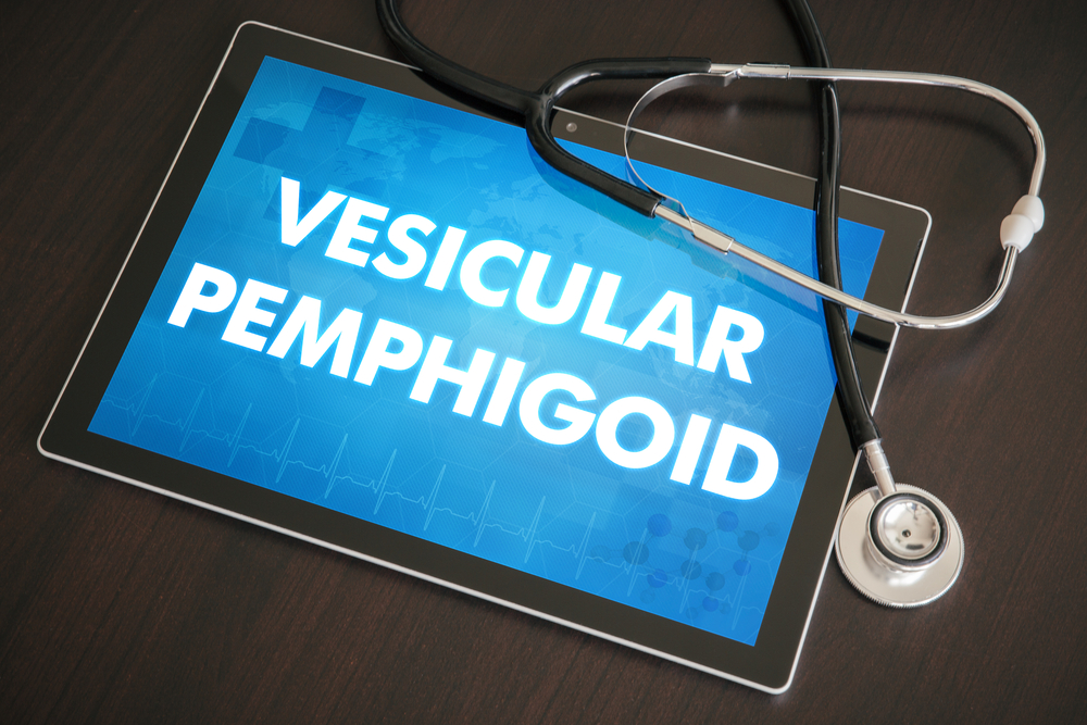 Pemphigoid: Symptoms, Causes, and Treatments - Facty Health