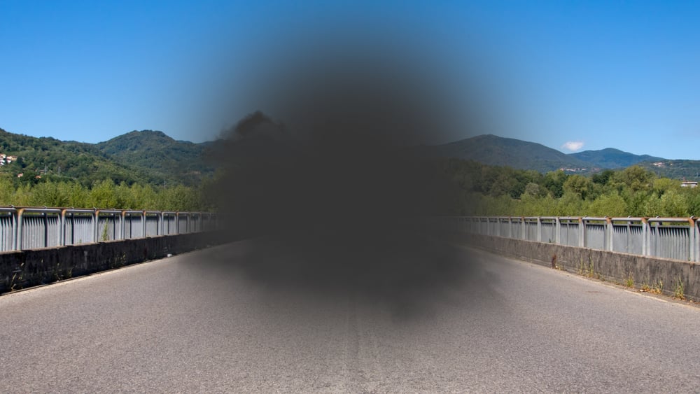 What Is An Ocular Migraine Facty Health