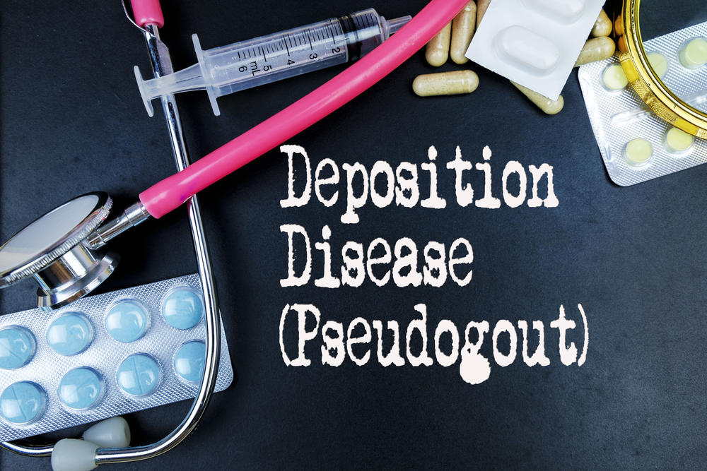 10 Facts About CPPD You Need to Know Now - Facty Health