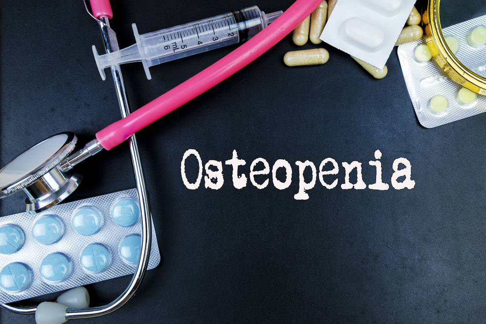 10 Treatments for Osteopenia - Facty Health