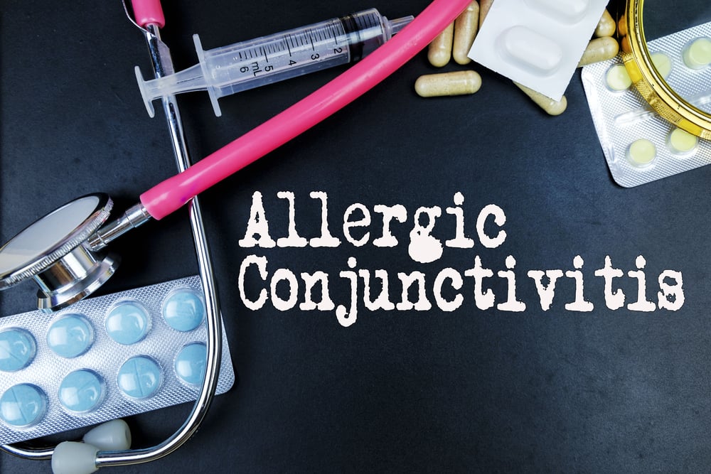 Allergic Conjunctivitis: Causes, Symptoms, and Treatments - Facty Health
