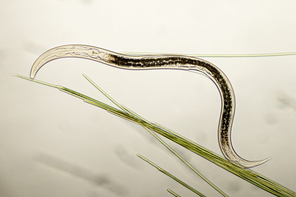 All About Worms in Poop - Facty Health