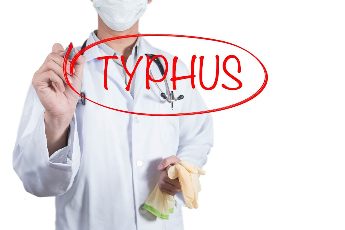 Causes, Symptoms, and Treatments of Typhus - Facty Health
