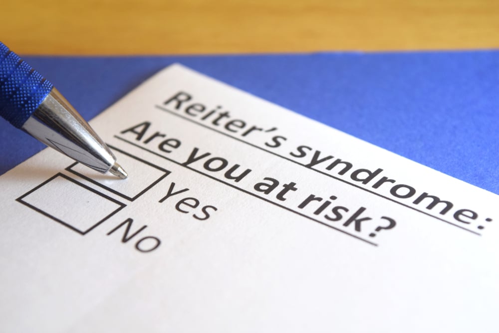 10 Facts About Reiter's Syndrome - Facty Health