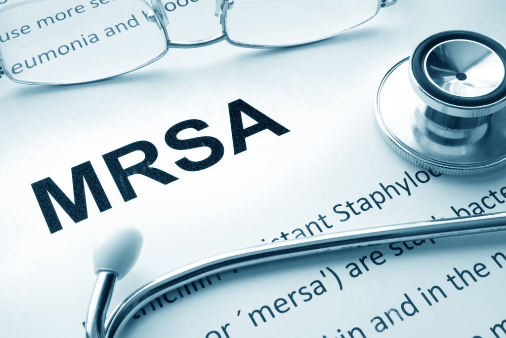 Causes of MRSA - Facty Health