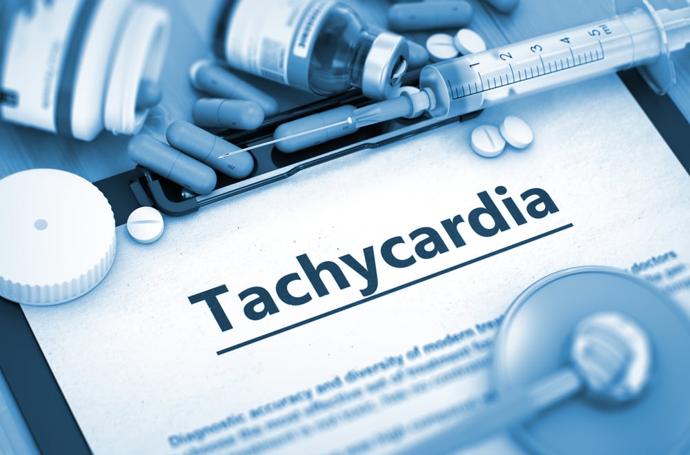 The Types of Tachycardia - Facty Health