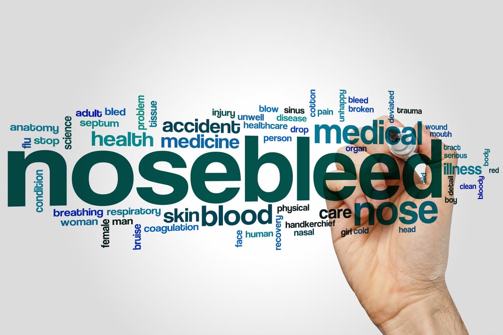 Treating Nosebleeds - Facty Health