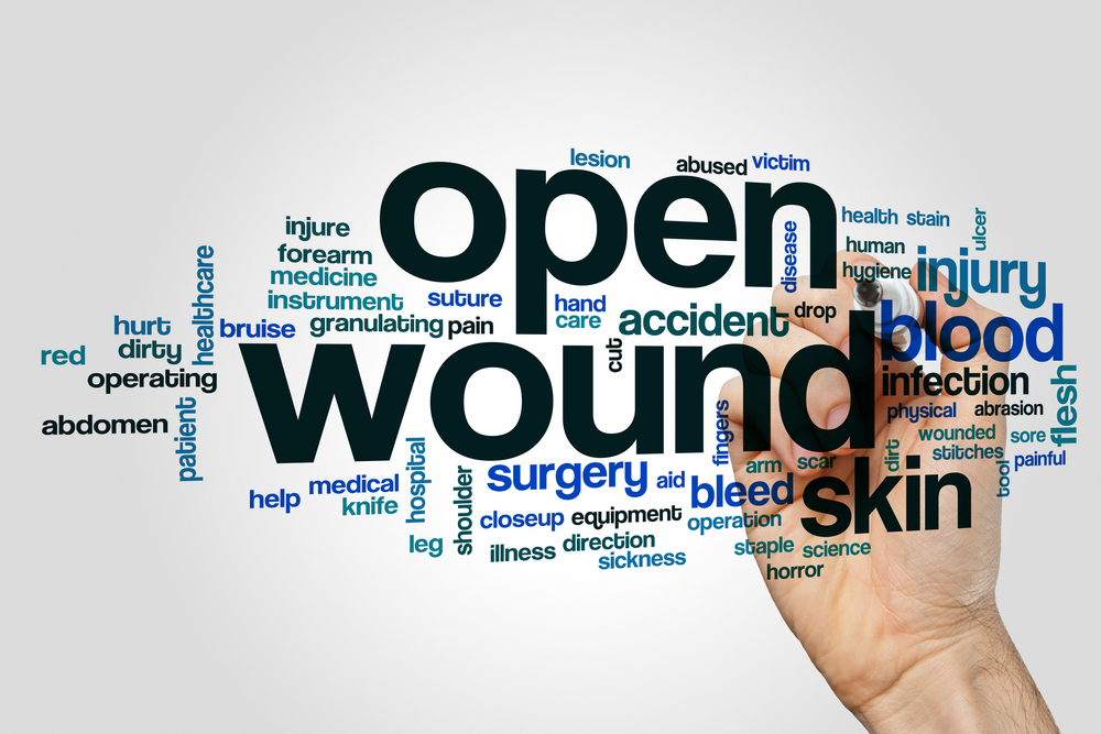 Frequently Asked Questions About Wound Infections - Facty Health
