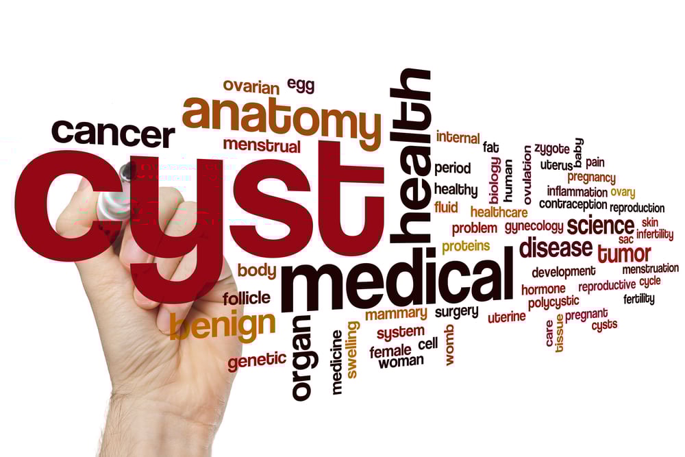 What Is Pilonidal Sinus - Facty Health