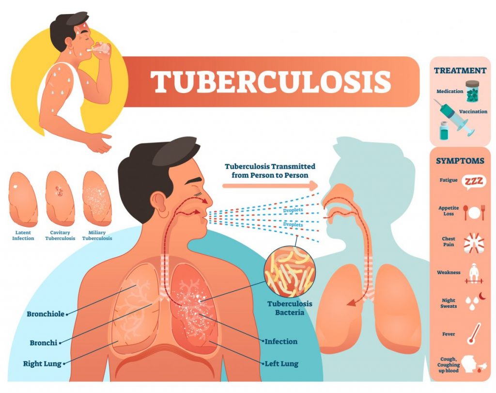 The 10 Most Common Communicable Diseases Facty Health