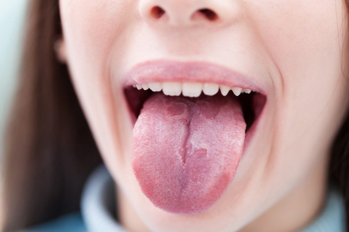 10 Facts About Glossitis - Facty Health