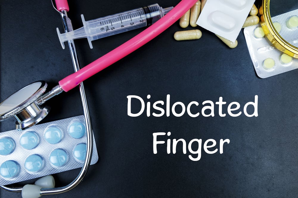 All About Finger Dislocation - Facty Health