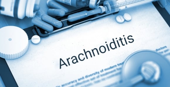 Causes, Symptoms, and Treatment Options for Arachnoiditis - Facty Health