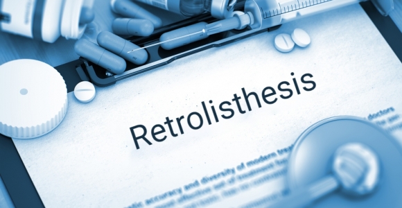 Retrolisthesis Can Result from Back Injury - Facty Health