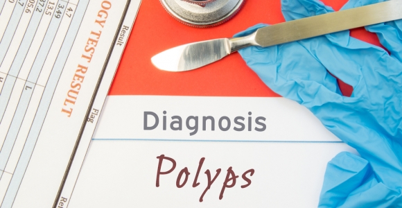 10 Facts About Polyps - Facty Health
