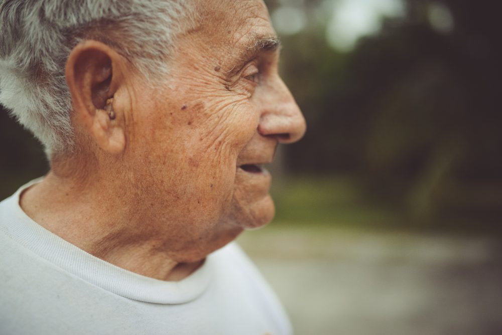 Parry Romberg Syndrome, a Rare Skin Disorder - Facty Health