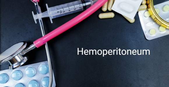 Hemoperitoneum and Abdominal Bleeding - Facty Health