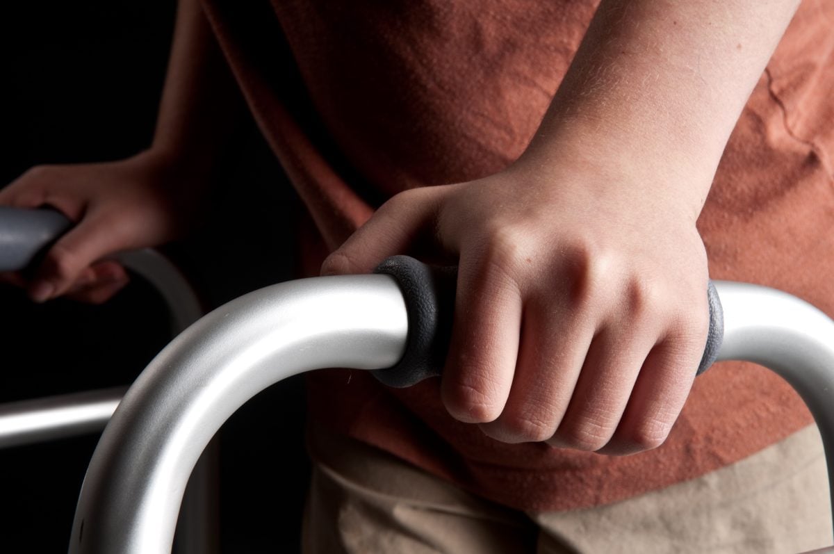 Congenital and Acquired Hemiparesis - Facty Health