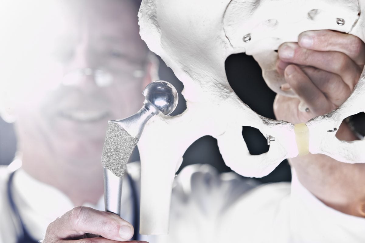 Causes, Effects, and Treatments of Osteolysis - Facty Health