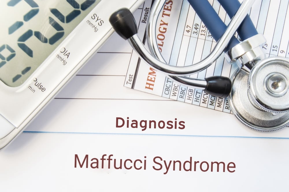 Maffucci Syndrome: Causes, Symptoms, and Treatment - Facty Health
