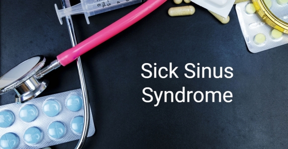 Sick Sinus Syndrome Affects the Heart, not the Nose - Facty Health