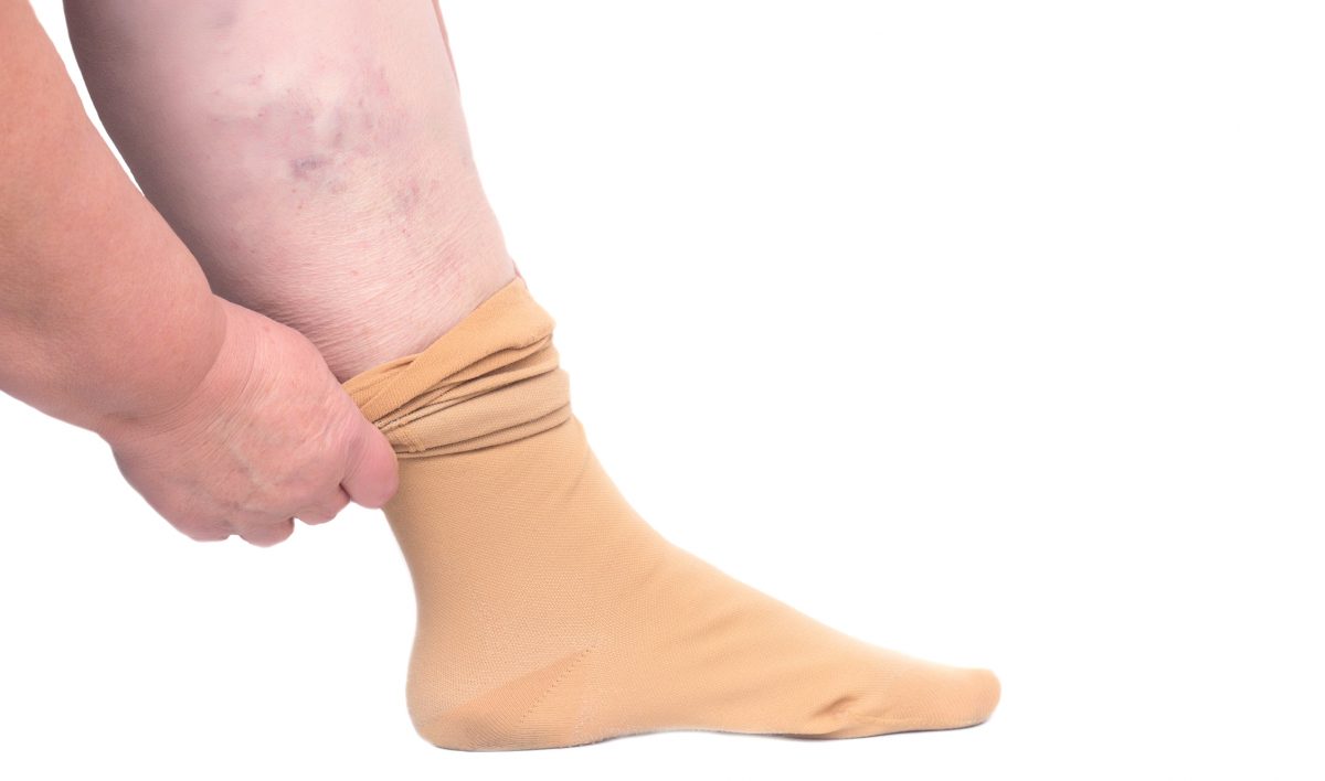 Anasarca: Generalized Edema - Facty Health