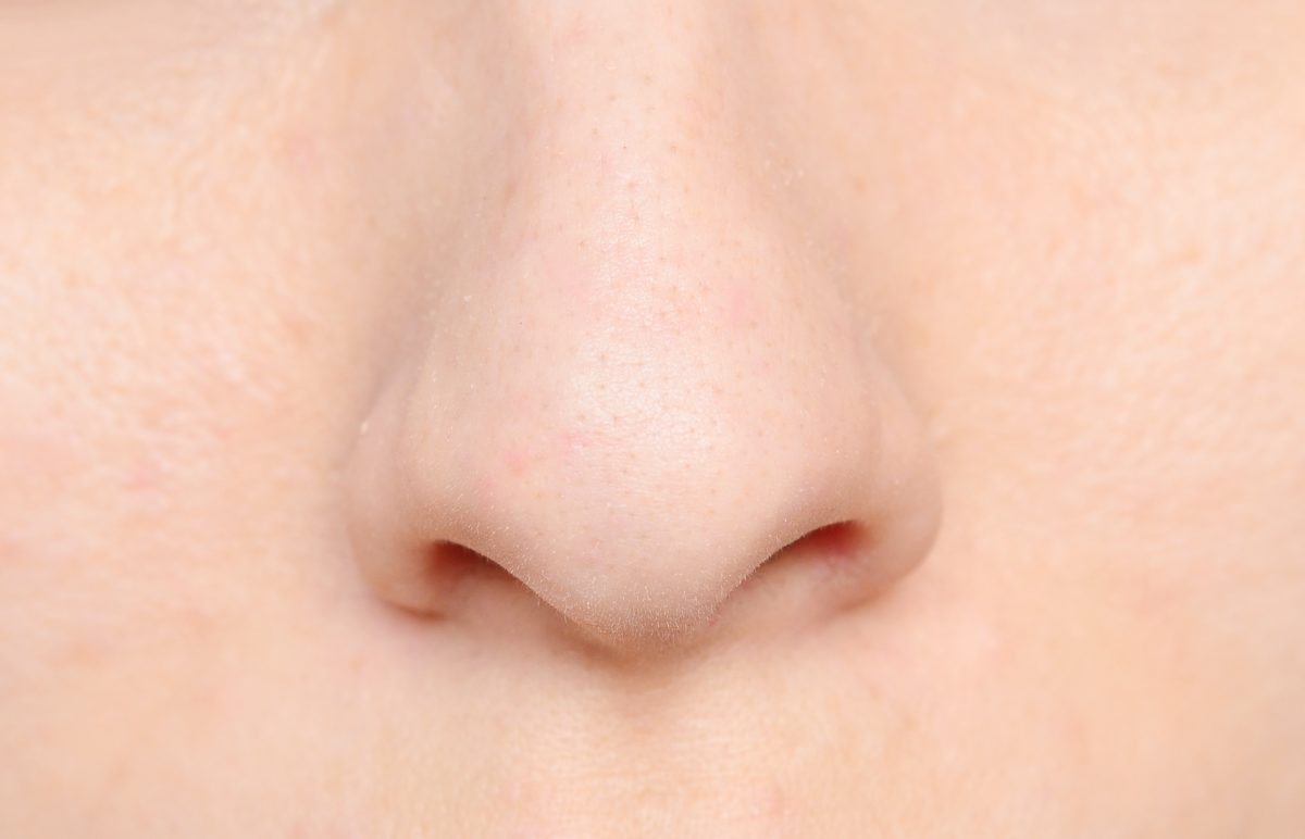What Are Dermoid Cysts Facty Health What Are Dermoid Cysts Facty Health