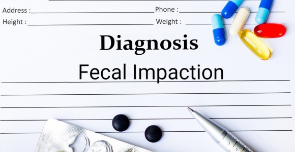 Fecal Impaction Causes and Consequences - Facty Health