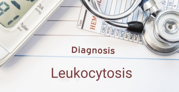 High White Blood Cell Counts and Leukocytosis - Facty Health