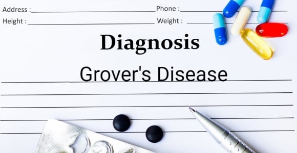 Grover's Disease: A Rare Skin Disorder - Facty Health