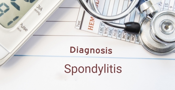 Eight Types of Spondylitis - Facty Health