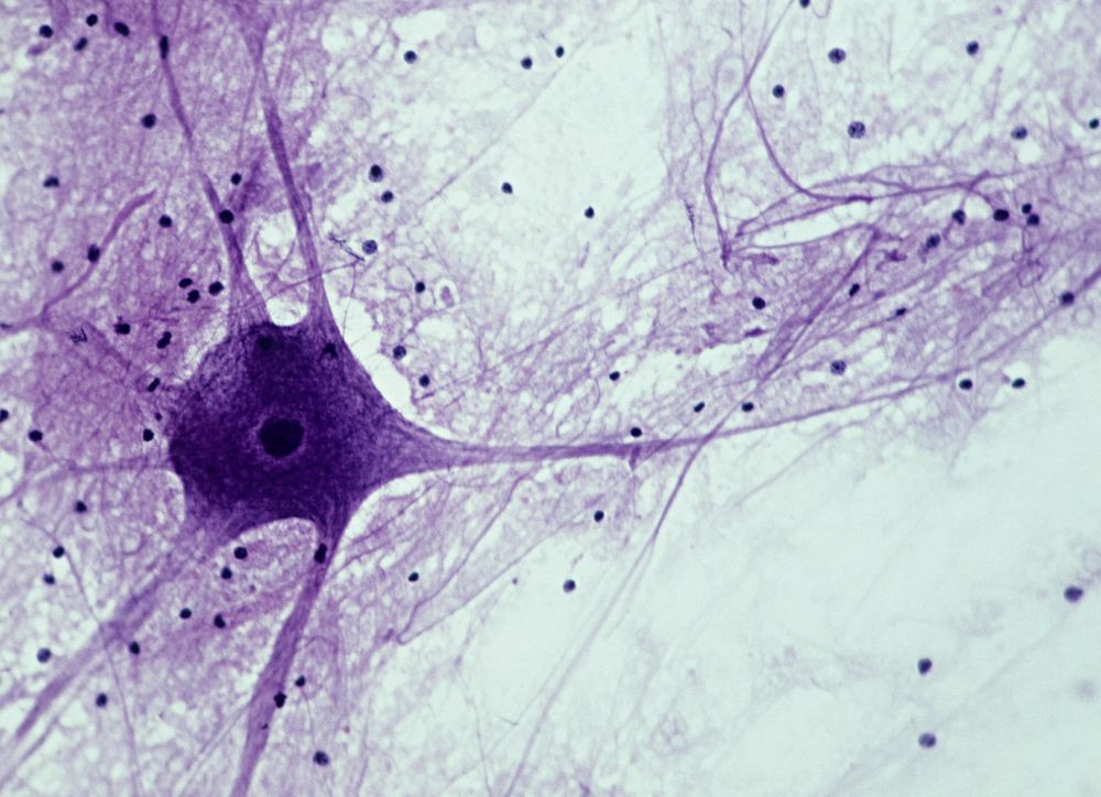 Neurogenic, Physiologic, and Pathologic Muscle Atrophy - Facty Health