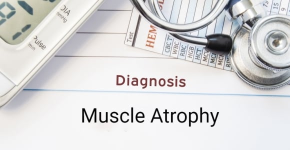 Neurogenic, Physiologic, and Pathologic Muscle Atrophy - Facty Health