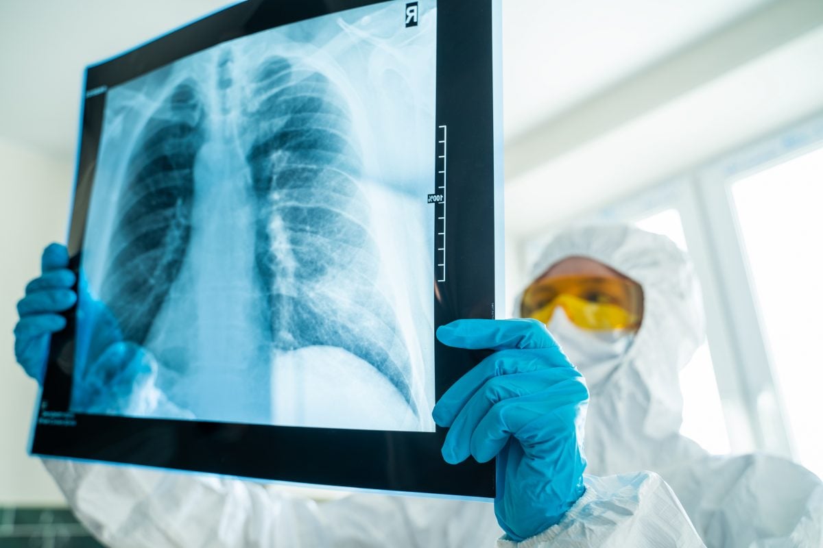 Anatomy of the Sternum - Facty Health