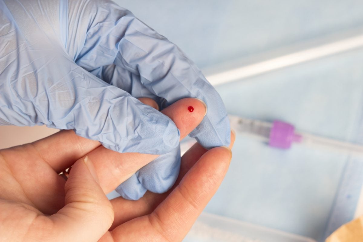 Should You Be Concerned About Your Blood Blister? - Facty Health