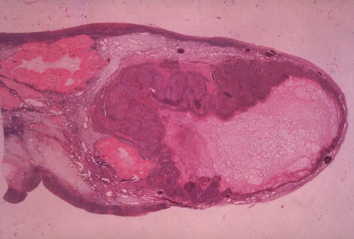 Why Does Ovulation Bleeding Occur? - Facty Health