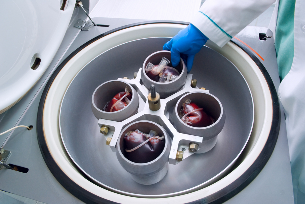 Plasmapheresis Or Therapeutic Plasma Exchange Facty Health
