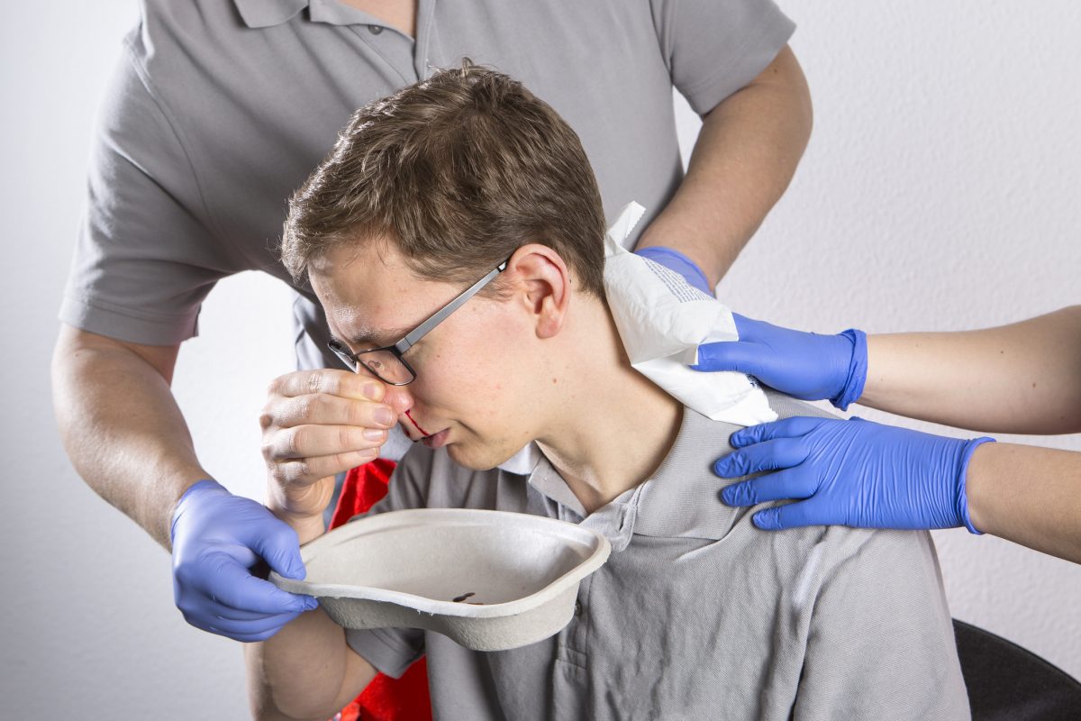 What You Should Know About a Broken Nose - Facty Health