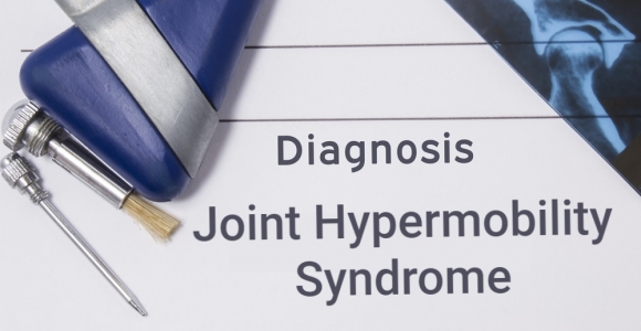 Joint Hypermobility Syndrome: More Than Just Flexible Joints - Facty Health