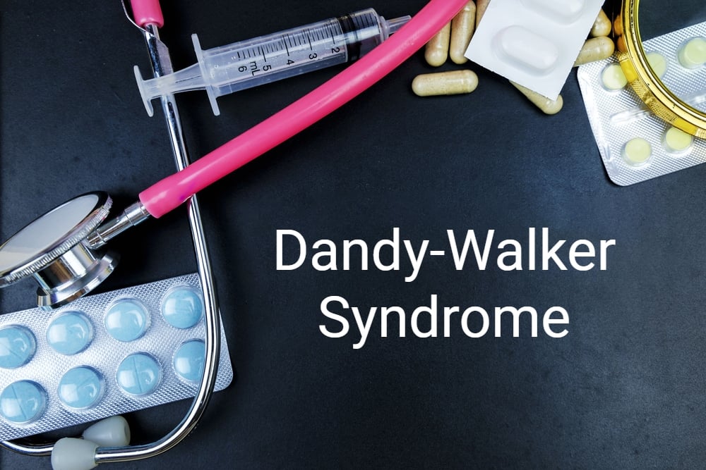 Dandy-Walker Syndrome: A Congenital Brain Malformation - Facty Health