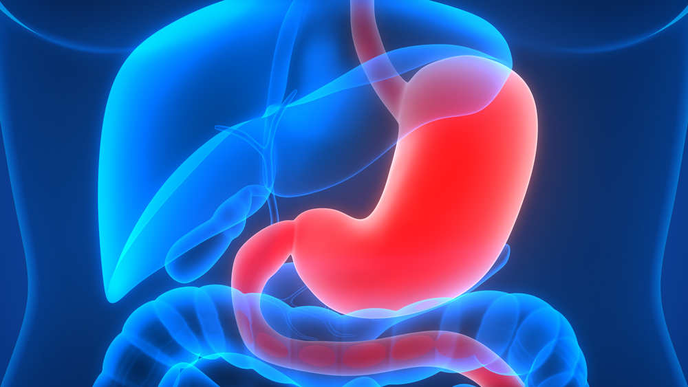 What are Gastrointestinal Stromal Tumors (GIST)? - Facty Health